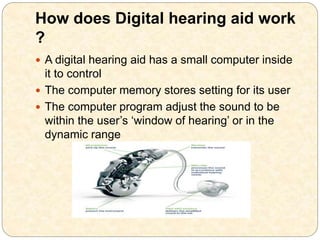 Digital Hearing aid | PPTX