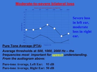 Hearing disorders | PDF