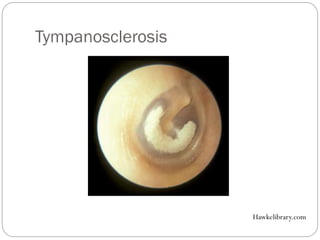 Hearing disorders review | PPTX | Ear, Nose and Throat Conditions ...