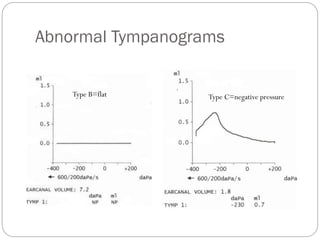 Hearing disorders review | PPTX