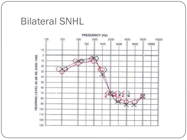 Hearing disorders review