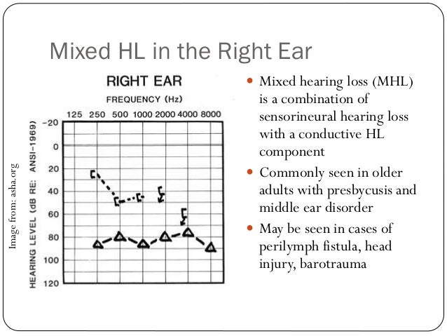 Hearing disorders review