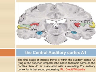 Hearing impairment ppt | PPTX