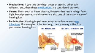 Hearing impairment | PPTX