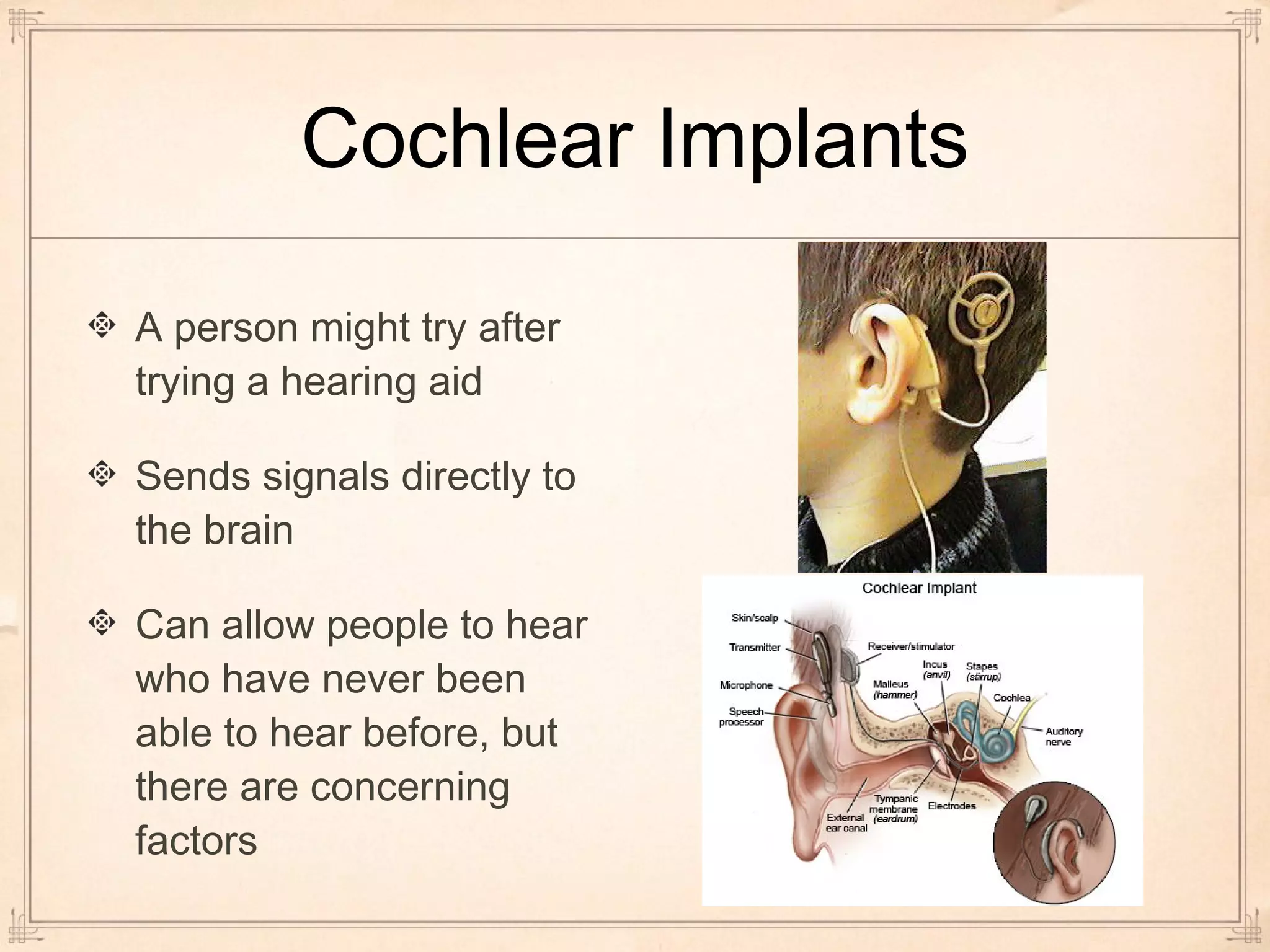 Hearing impairment presentation | PPT