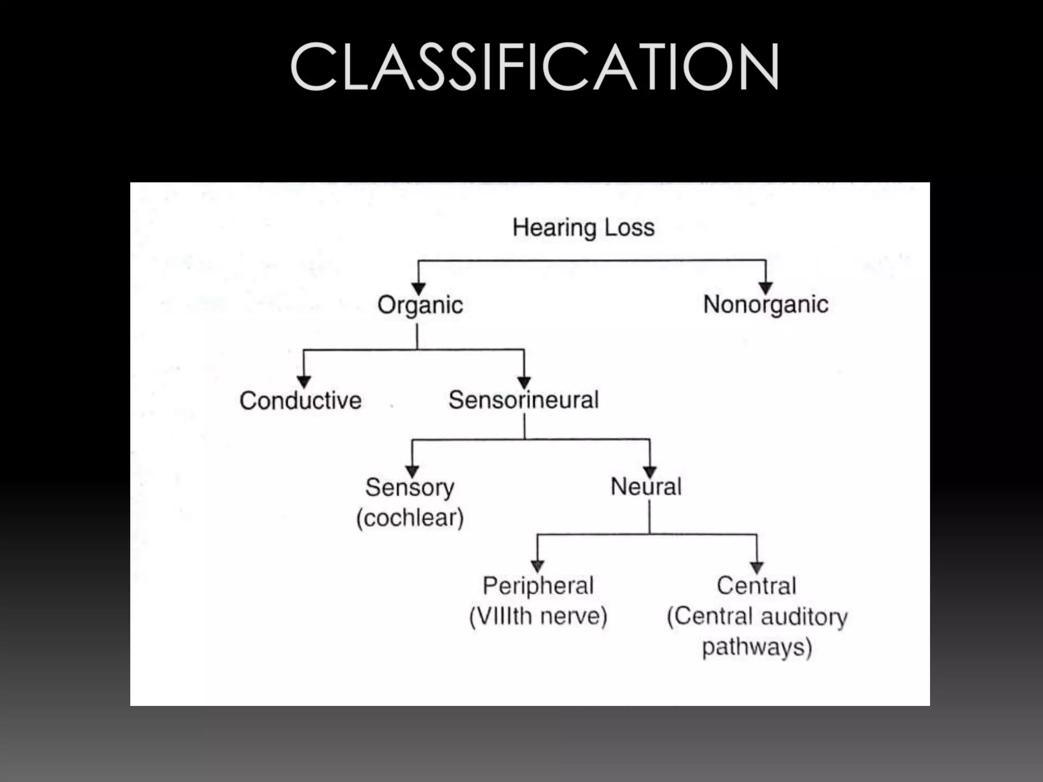 Hearing loss | PPSX
