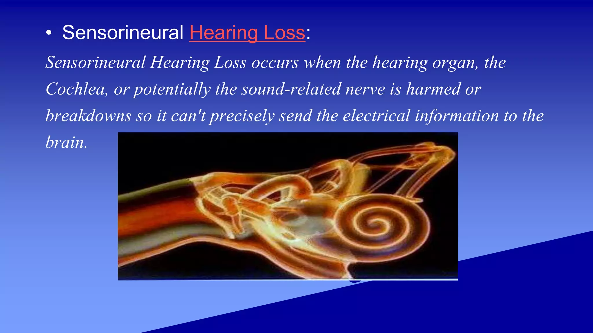 Hearing loss | PPT