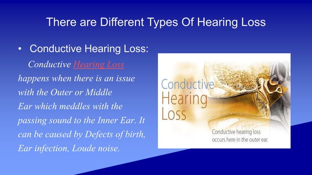 Hearing loss | PPT