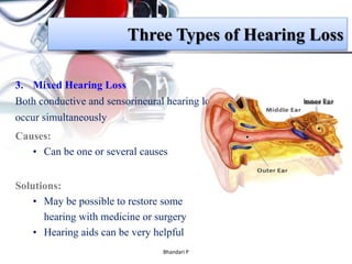 Hearing loss | PPT