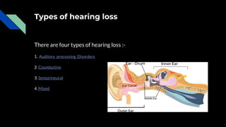 Hearing loss | PPT | Free Download