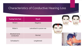 Hearing loss | PPTX
