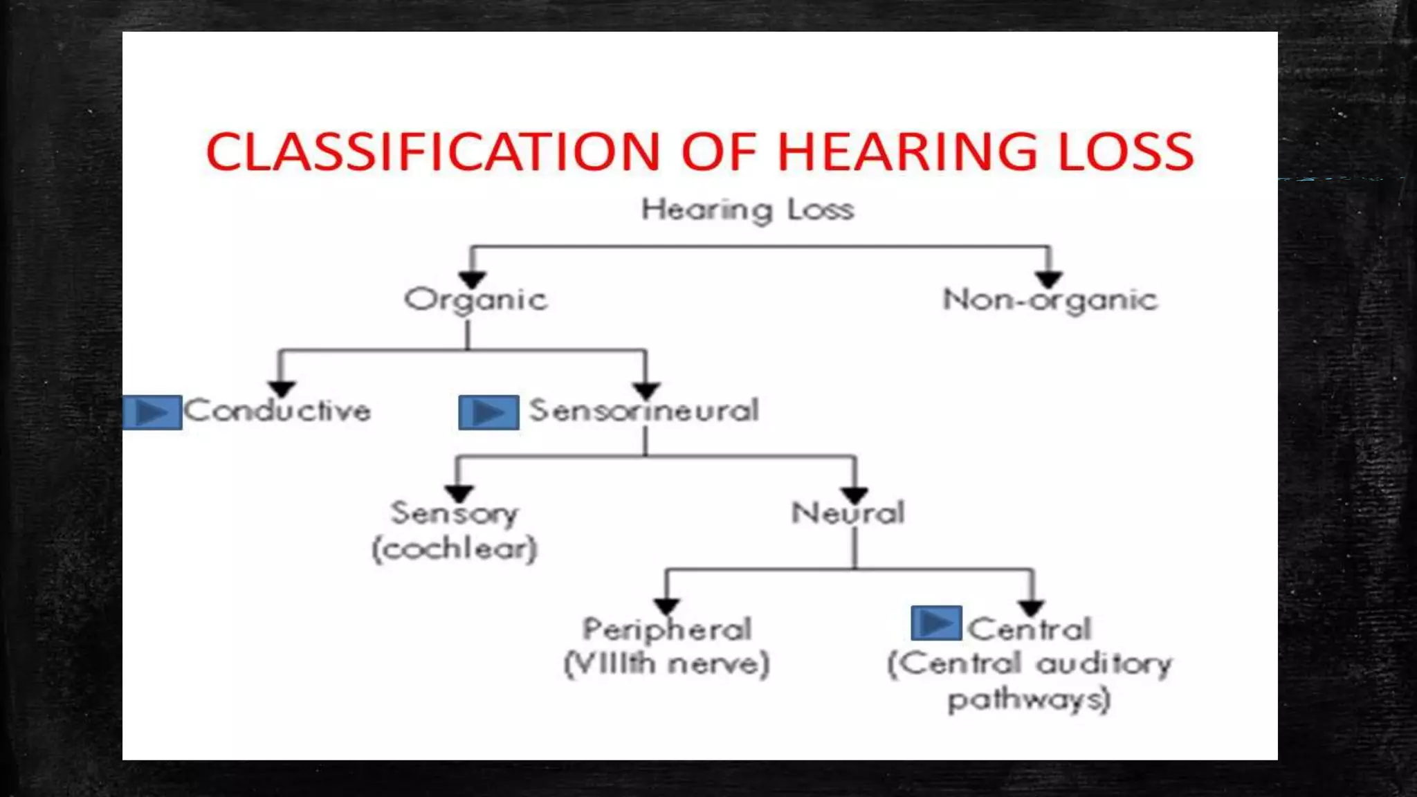 Hearing loss | PPT