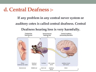 Central Hearing Loss