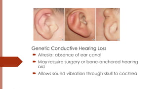 characteristics of deafness and hearing loss.pptx