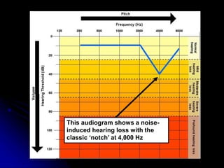 Hearing Loss & Speech Sounds | PPT | Digital Audio | Computer Software ...