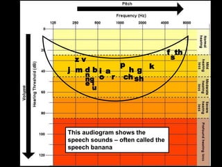 Hearing Loss & Speech Sounds | PPT | Digital Audio | Computer Software ...