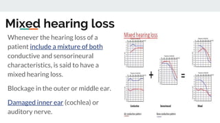 Hearing loss | Cause of hearing loss | Symptoms | Hearingsol | PPTX