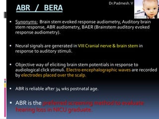 Hearing Screening in Newborns.. Dr.Padmesh | PPTX