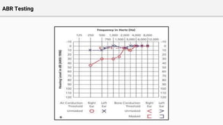 Hearing test | PPTX