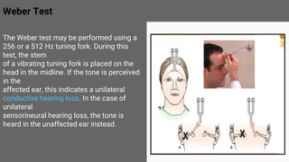 Hearing test | PPT