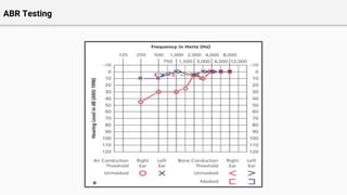 Hearing test | PDF