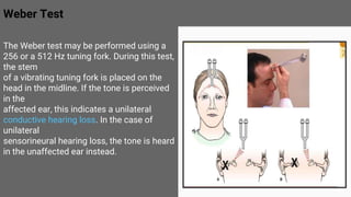 Hearing test | PDF