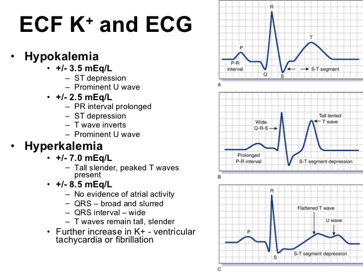 Medicowesome Ecg Changes Seen In Hyperkalemia And