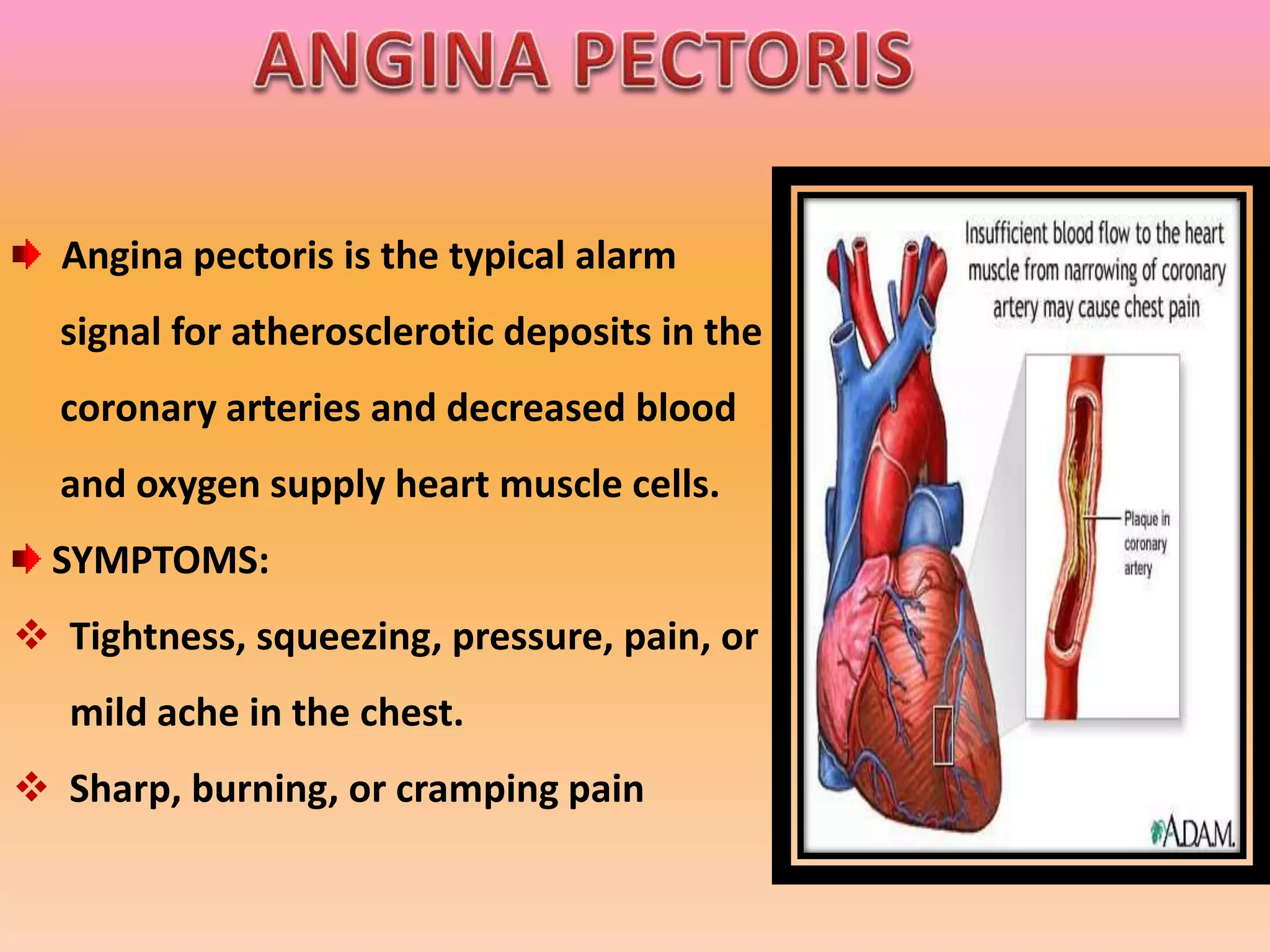 Heart and its disease | PPTX