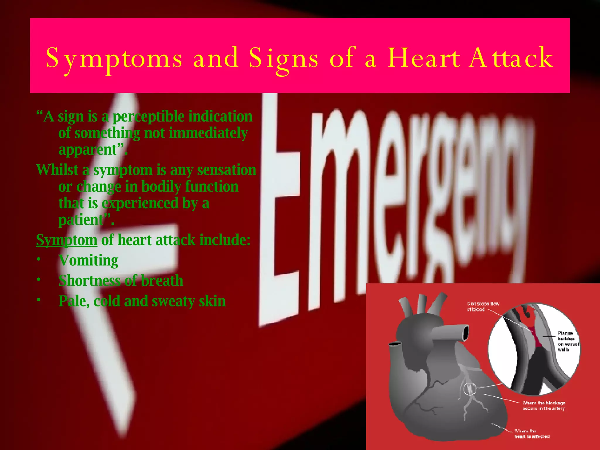 Heart Attack | PPT