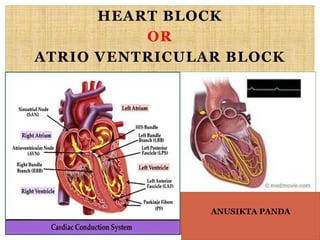 Heart-Block-ppt.pptx