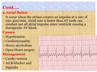 Heart-Block-ppt.pptx