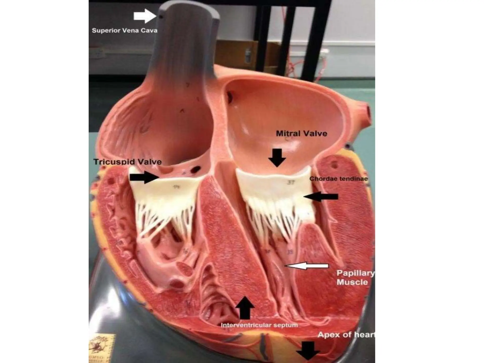 Heart - External Features , Chambers copy.pptx