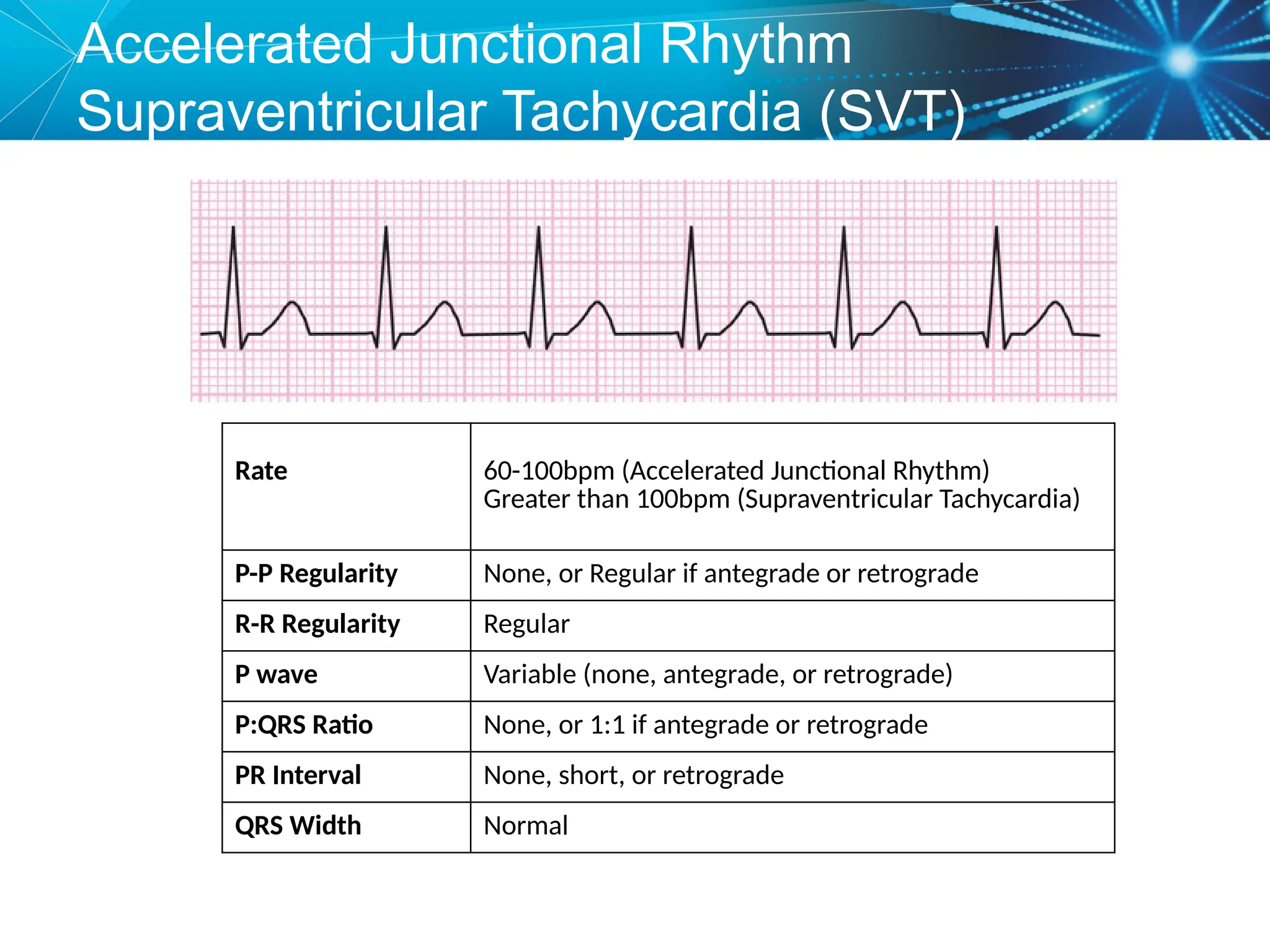 Heart-Rhythm-Interpretation-ECG-Stripllls-2012 CC_1.pptx