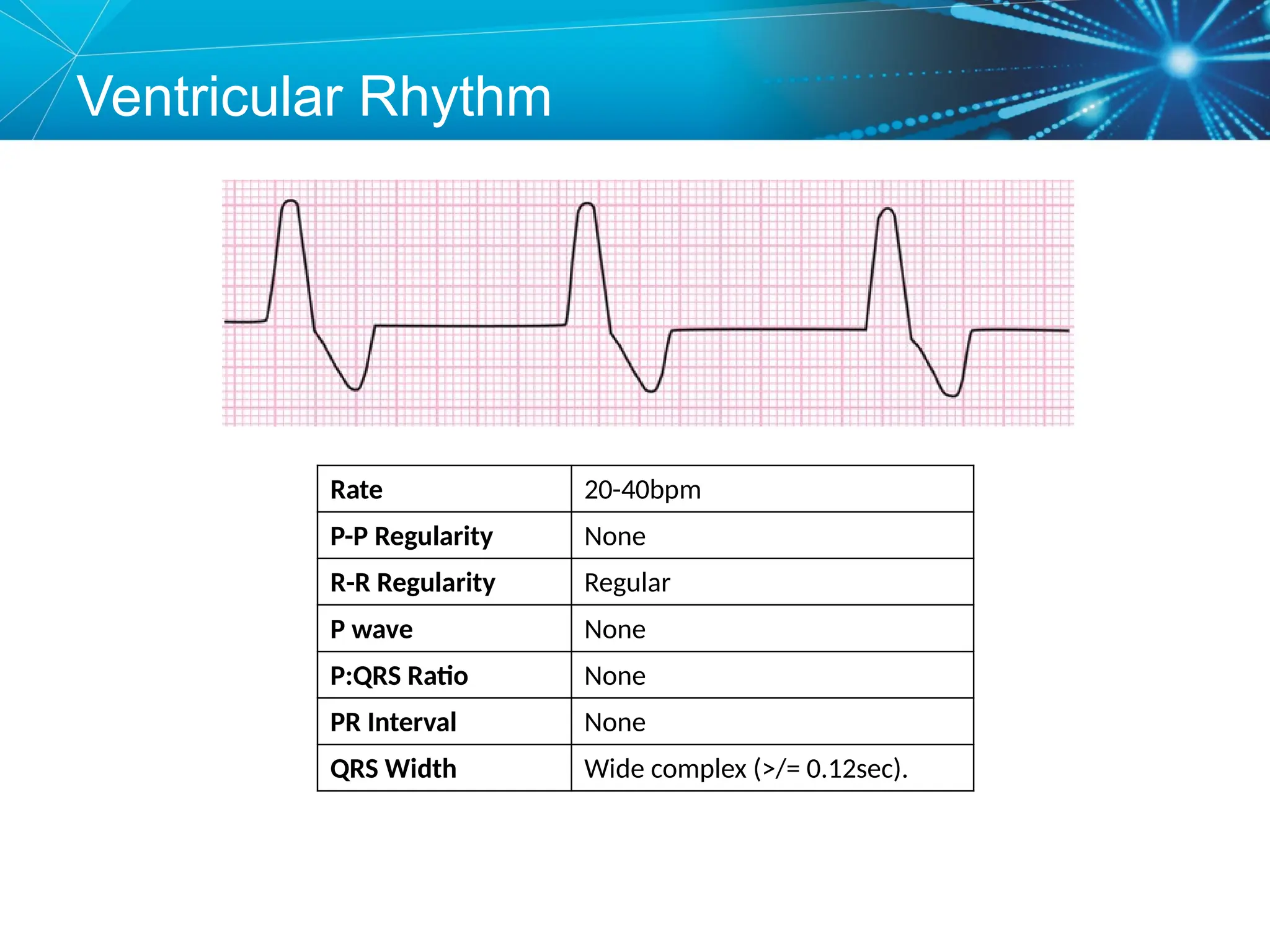 Heart-Rhythm-Interpretation-ECG-Stripllls-2012 CC_1.pptx