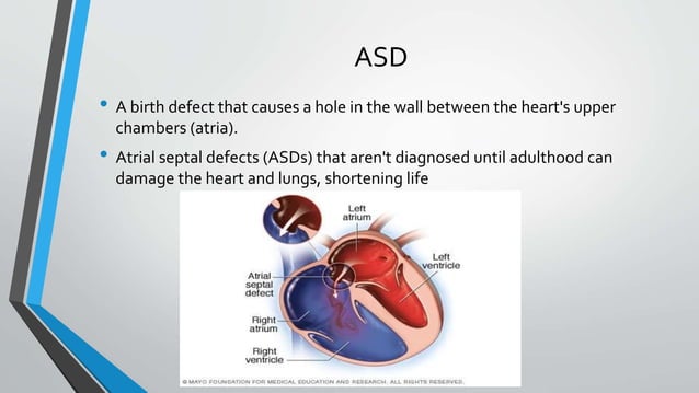 heart ( Cardiac condition).pptx