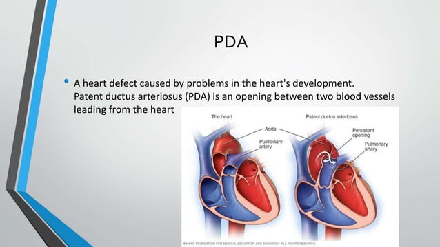 heart ( Cardiac condition).pptx