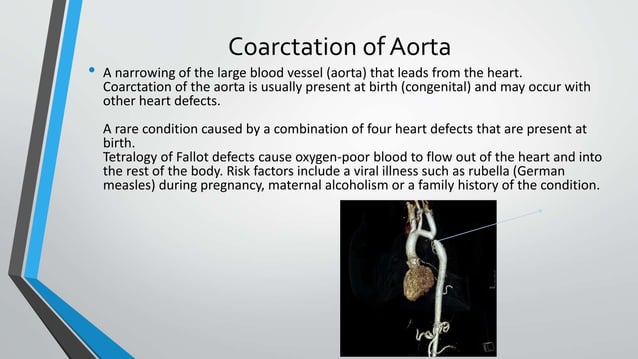 heart ( Cardiac condition).pptx