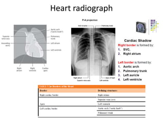 Heart Anatomy.pptx