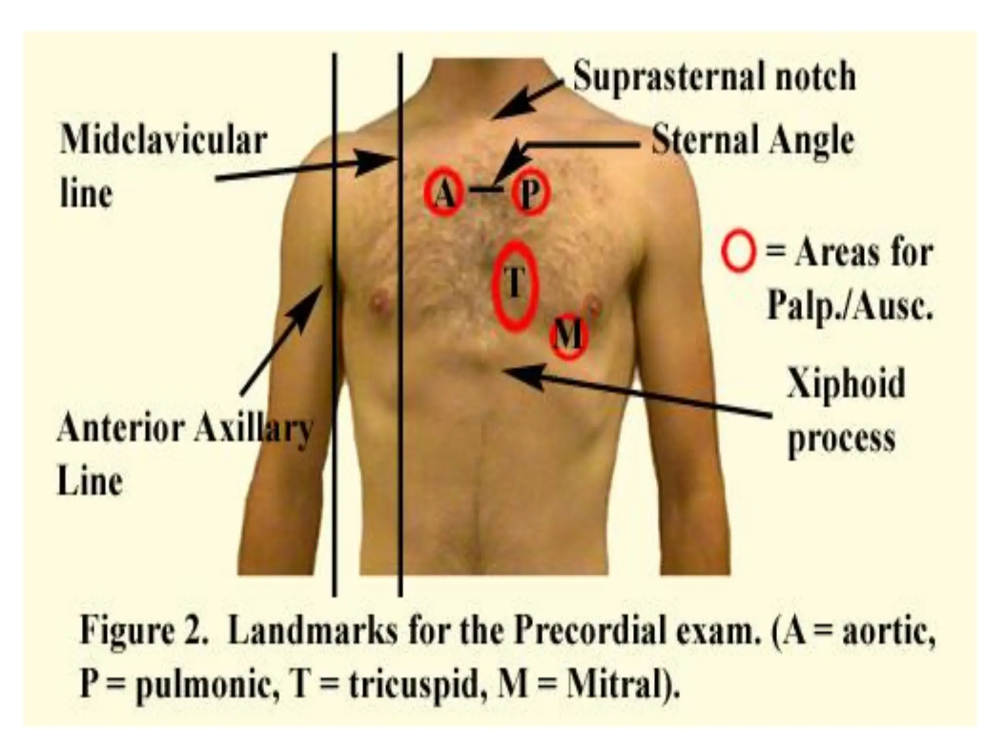 Heart and Chest auscultation and heart sounds | PPT
