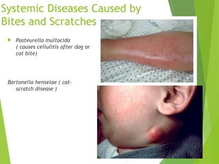 Heart and Lymph system infection and its effects.ppt