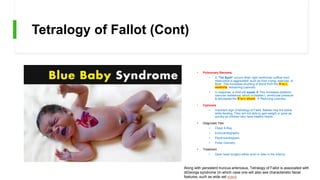 Heart Article Exam Clinicals .pptx