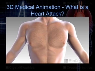 Heart attack | PPTX