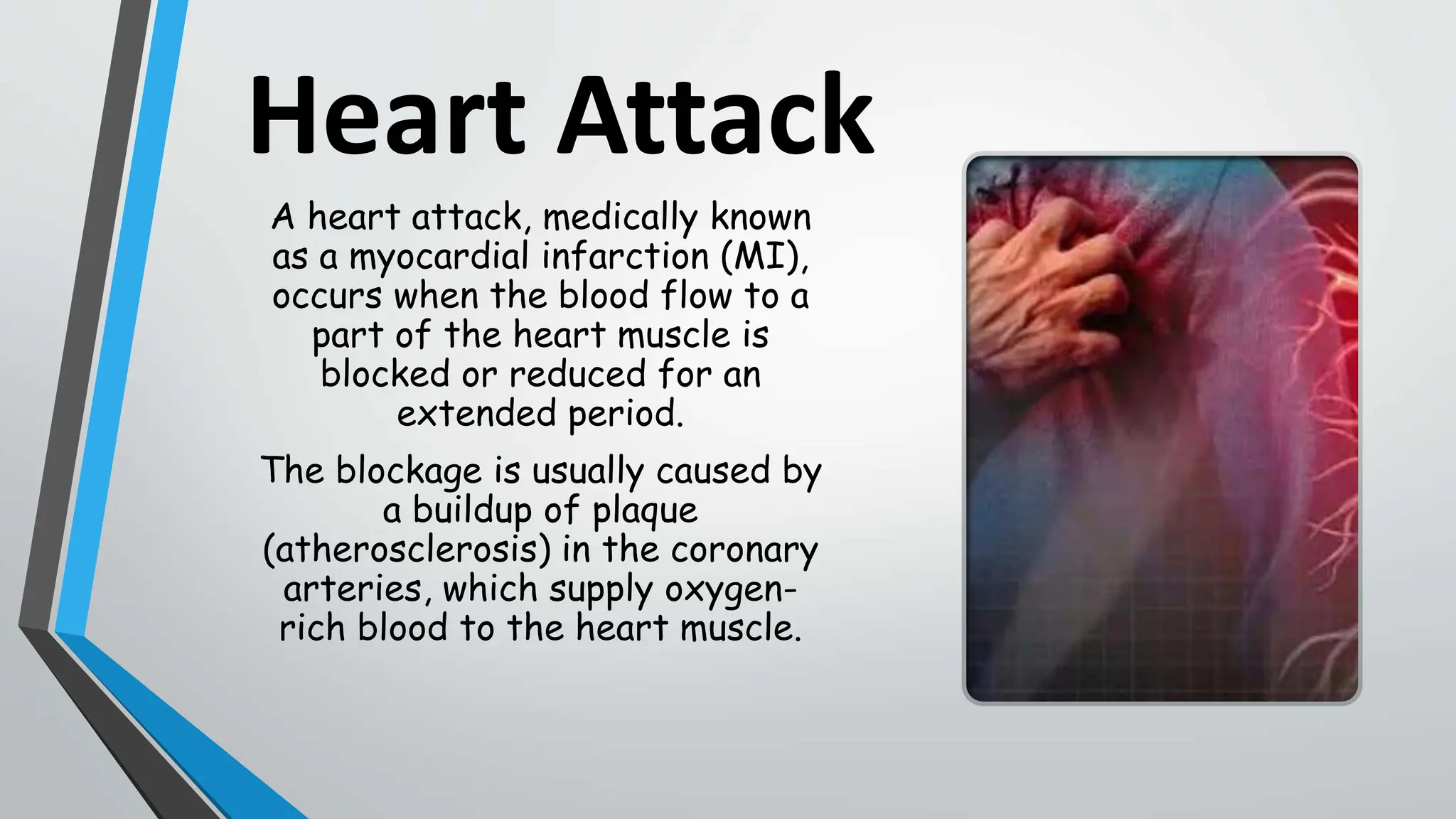 Heart Attack: Recognizing the Warning Signs and Taking Action | PPTX ...