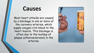 Heart Attack: Recognizing the Warning Signs and Taking Action | PPTX