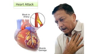 Understanding First Aid For Heart Attack | PPTX