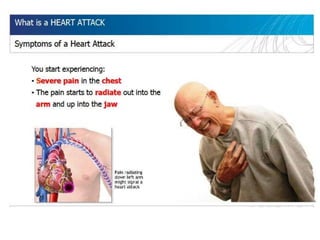 Heart attack | PPT