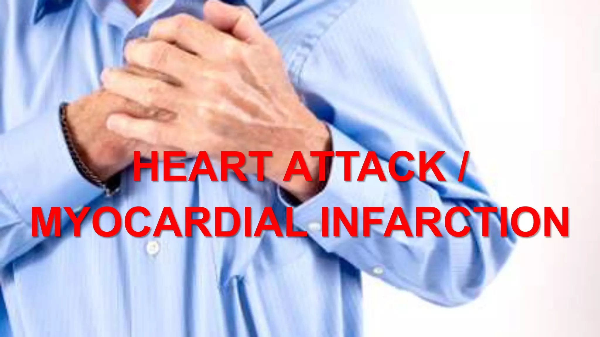 Myocardial Infarction AKA Heart Attack | PPTX