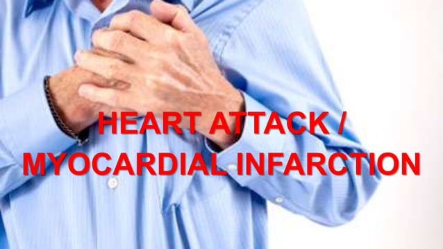 Myocardial Infarction Aka Heart Attack Ppt