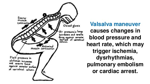 Myocardial Infarction Aka Heart Attack
