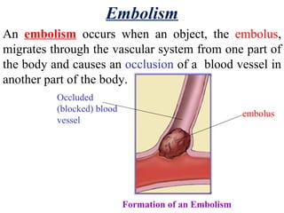 Heart attack plaque blood pressure | PPT